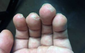 Ultimate Guide to Guitar Finger Pain: Stop Sore Fingers - Guitar Gear ...